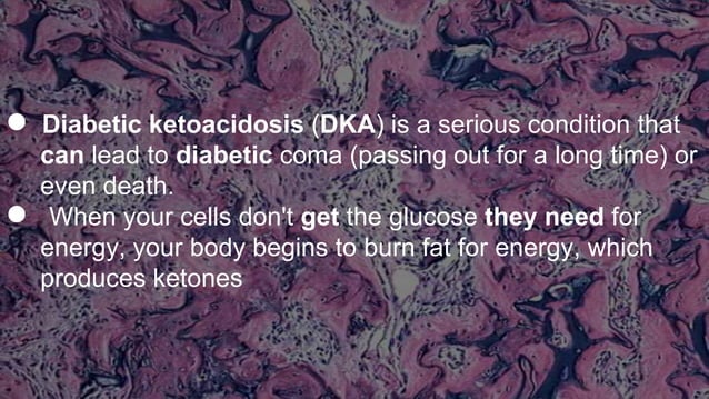 Diabetic ketoacidosis | PPTX