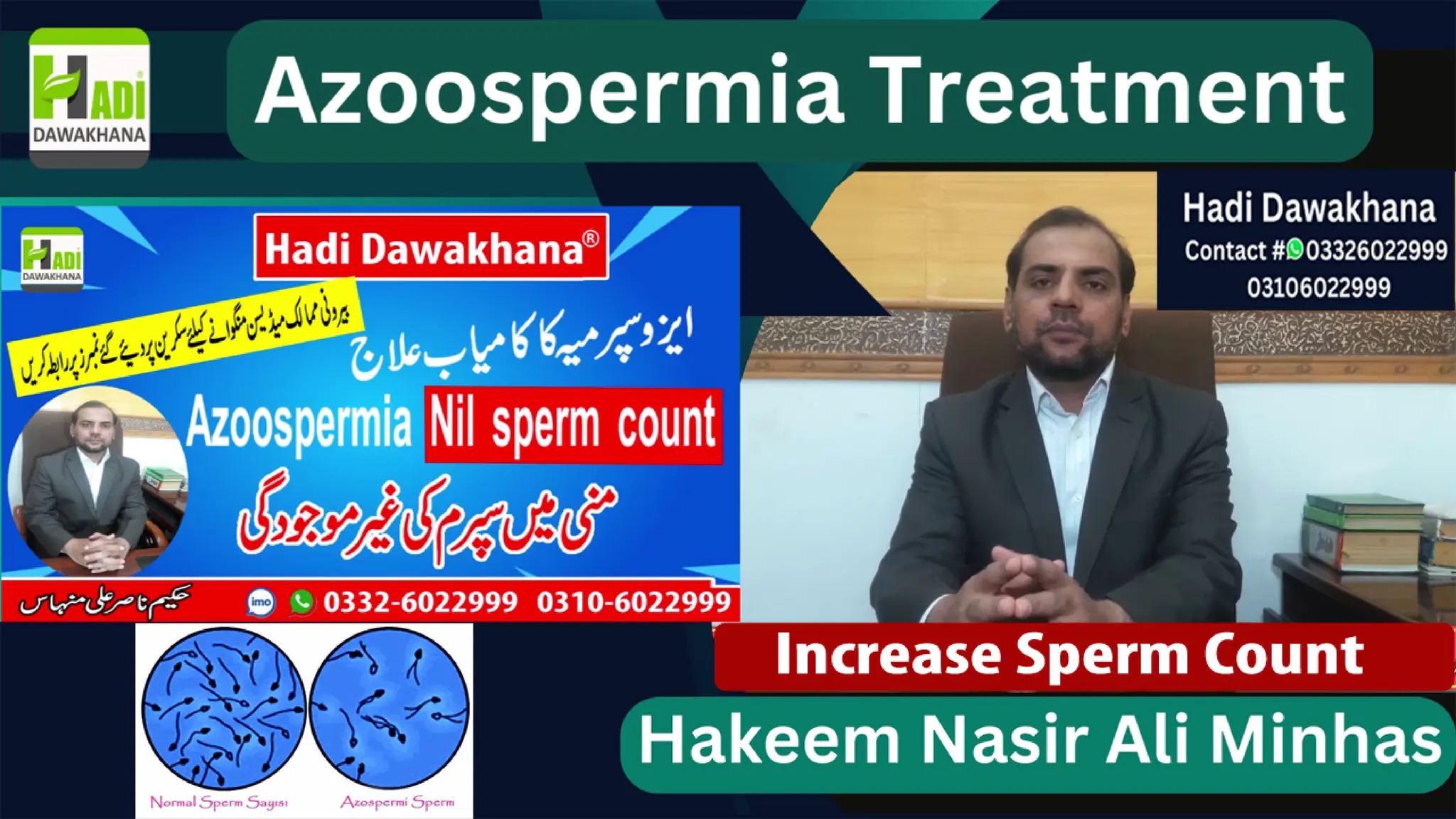 Azoospermia ka ilaj | Zero sperm count ka ilaj | Mardana banjhpan ka ...
