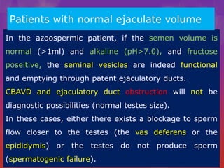 Azoospermia | PPTX