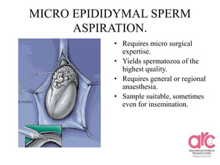 Azoospermia by Dr.Saravanan | PPTX