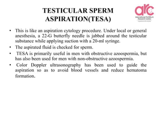 Azoospermia by Dr.Saravanan | PPTX