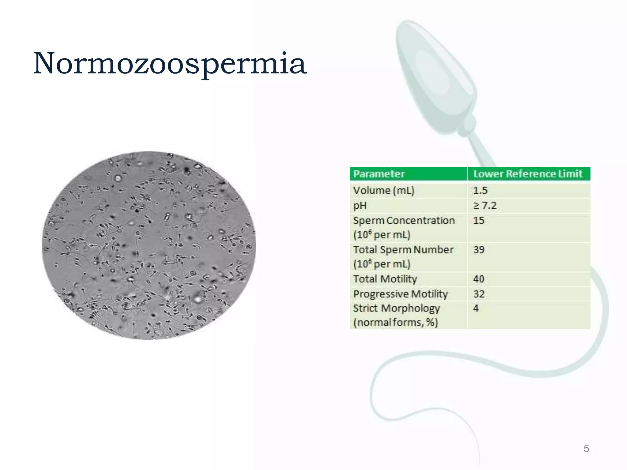 Azoospermia | PPTX