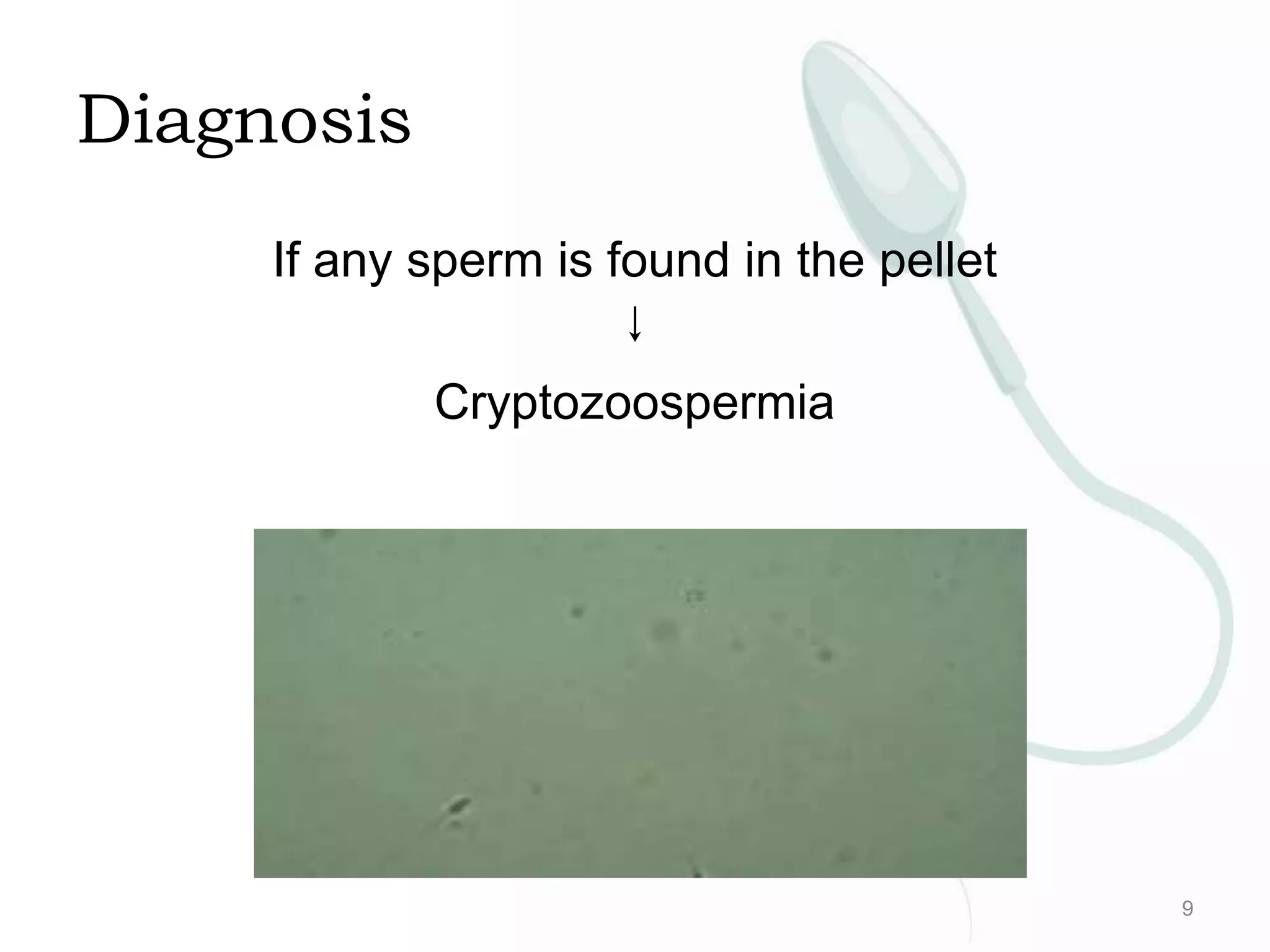 Azoospermia | PPTX