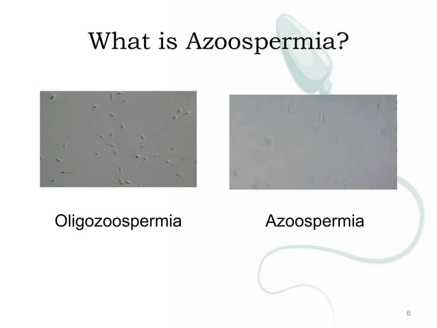 Azoospermia | PPTX