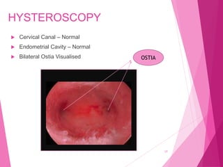 Azoospermia case | PPTX | Infertility | Reproductive Health