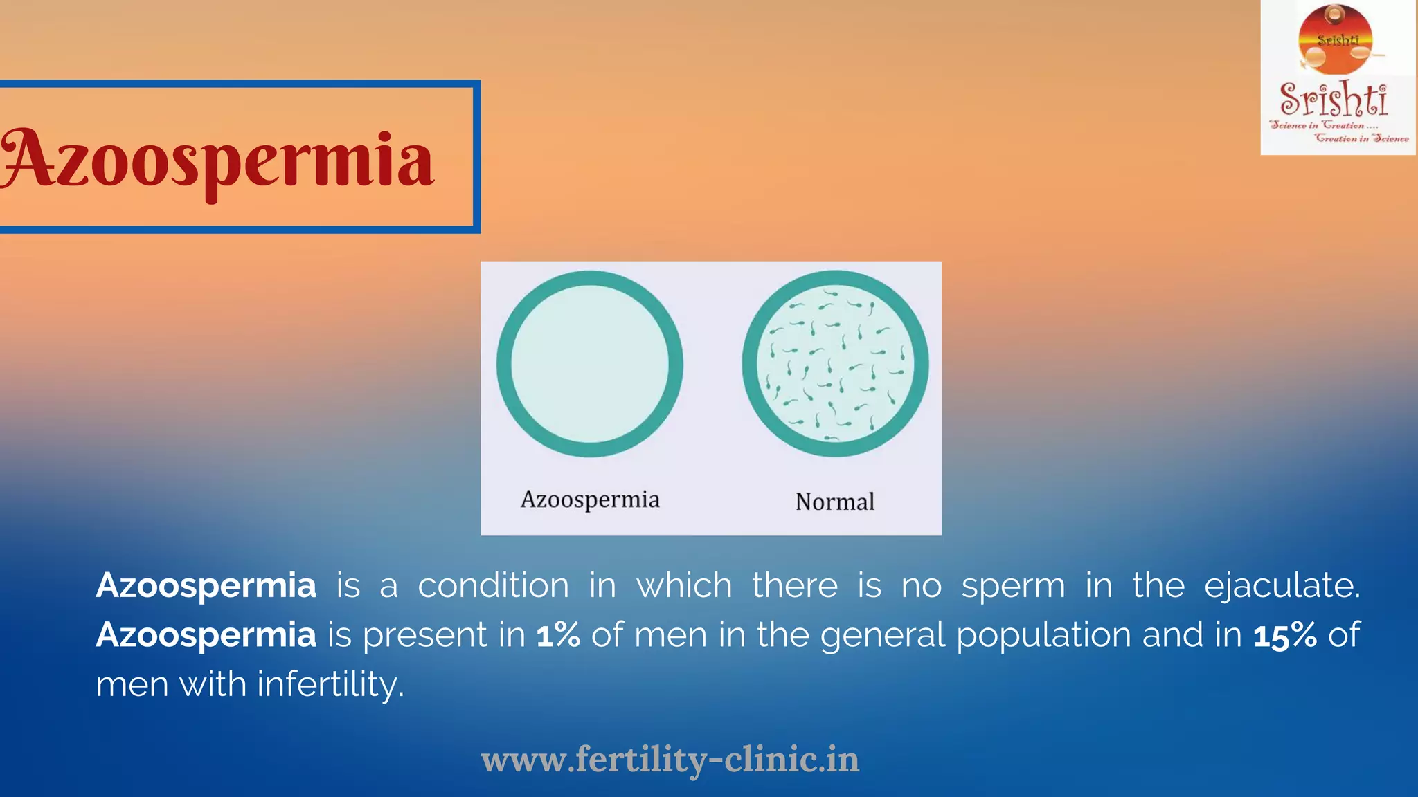Azoospermia: Causes, Diagnosis and Treatment | PDF