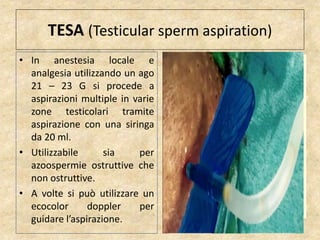 Azoospermie e prelievo degli spermatozoi dai testicoli grosseto 18 ...