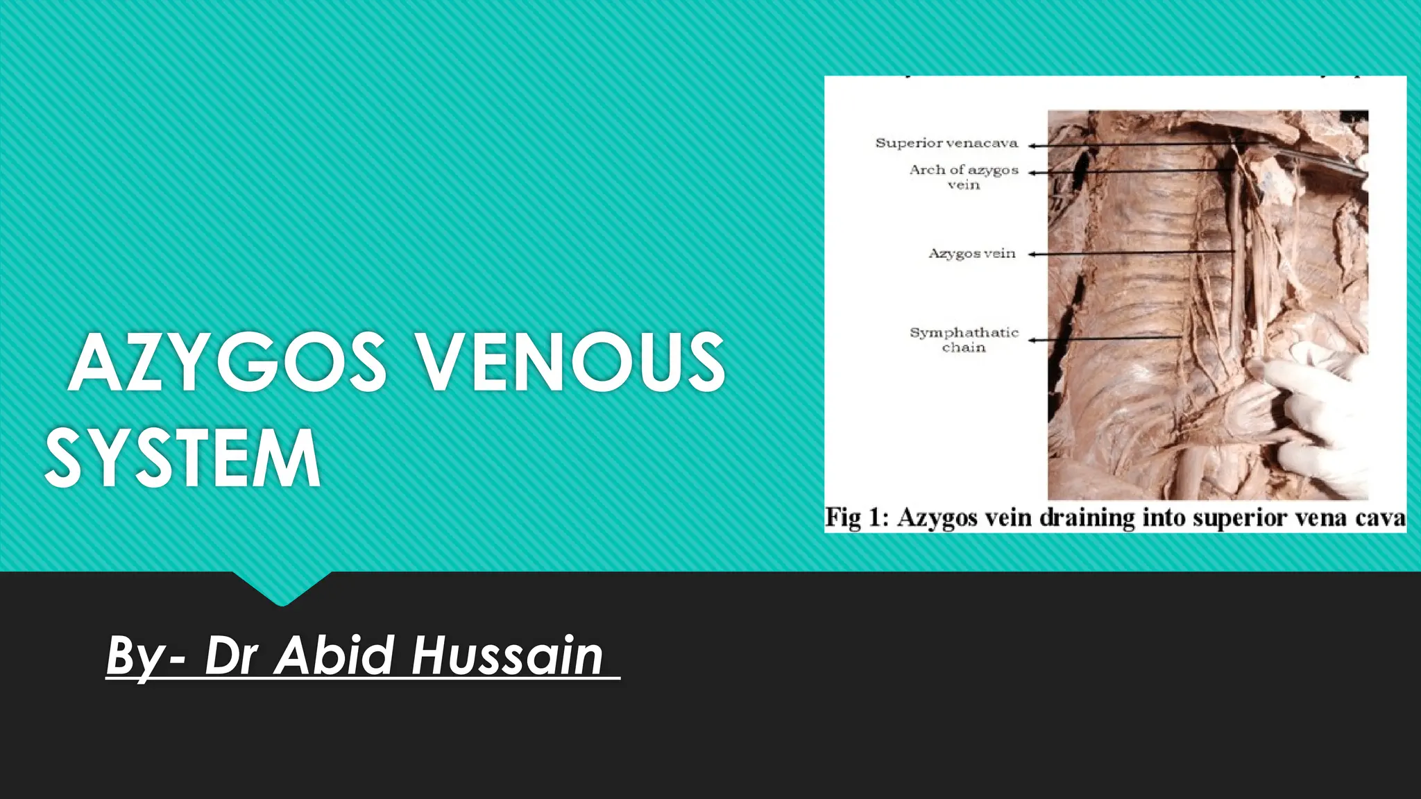 AZYGOS VENOUS SYSTEM.pptx full note anatomy | PPTX