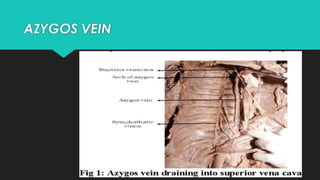 AZYGOS VENOUS SYSTEM.pptx full note anatomy | PPTX