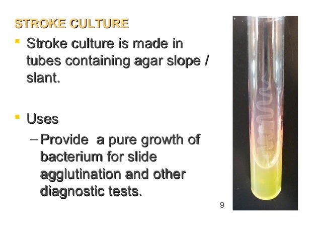 B.sc. (micro) i em unit 4.4 culturing & isolating