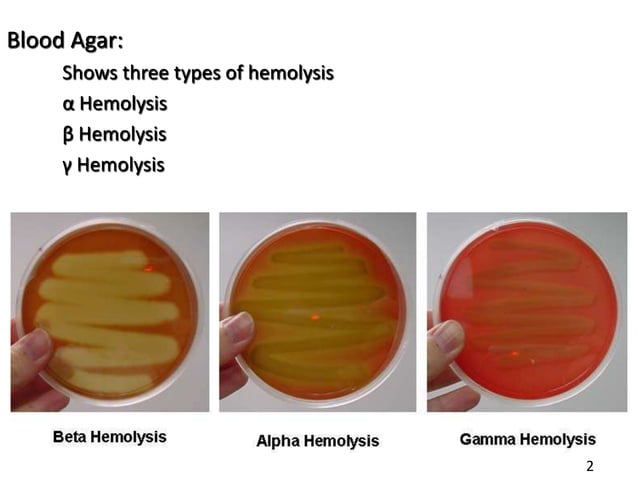 B.Sc. Microbiology II Bacteriology Unit 4.2 Culture Media | PPT