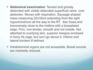 Case History of Dedifferentiated Liposarcoma | PPTX