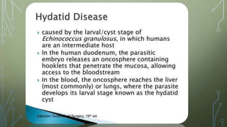 hydatid disease | PPT