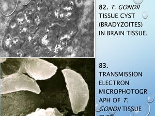 toxoplasma gondii | PPTX