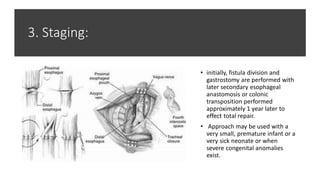 Tracheoesophageal fistula | PPT