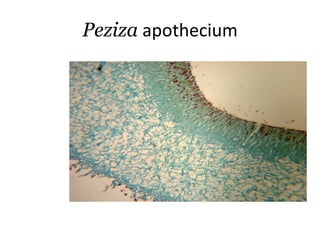 Peziza Slide