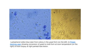 B. dermatitidis Knowledge of Microorganism involoved in skin.pptx