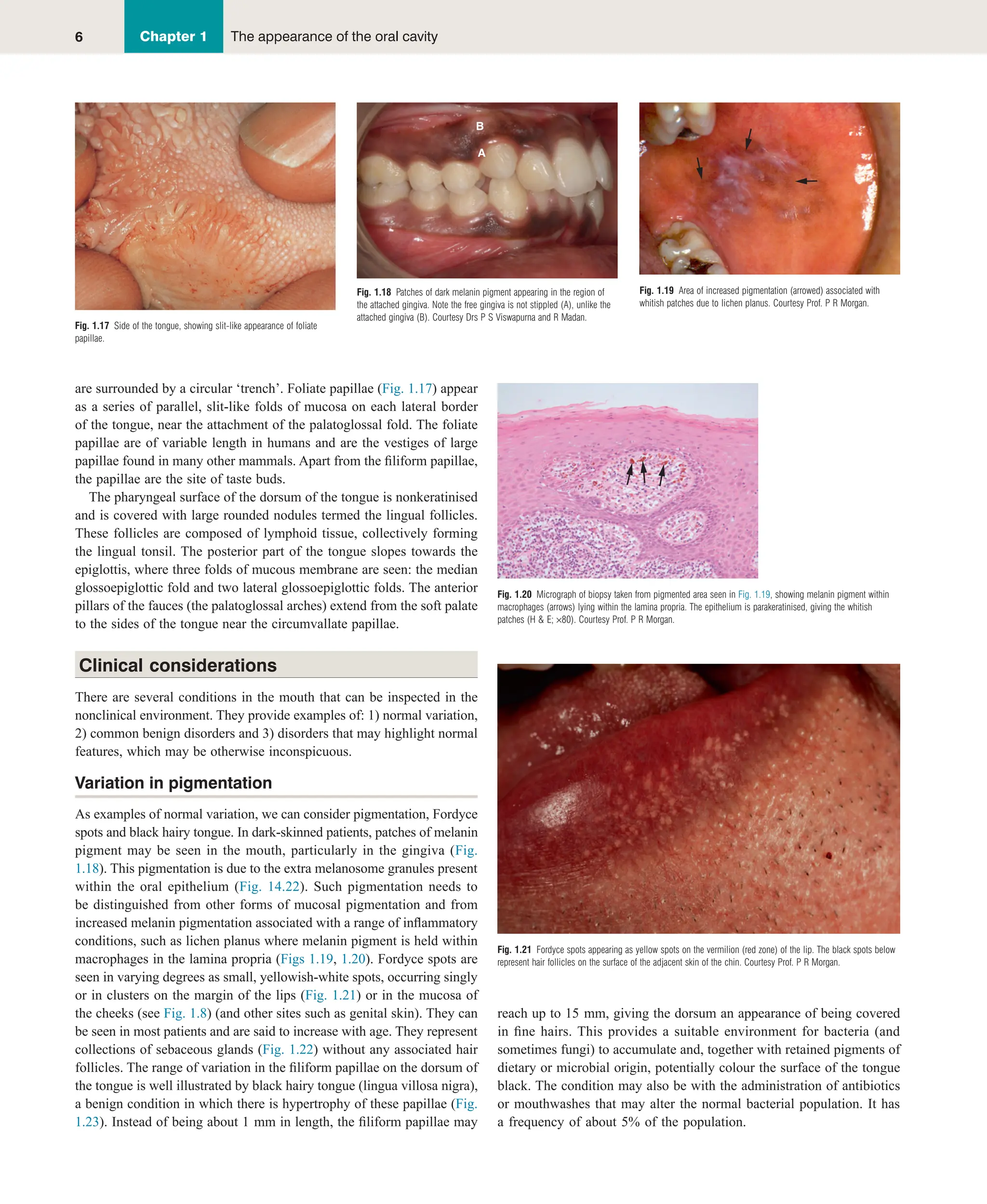 B.K.B. Berkovitz_ G R Holland_ Bernard J Moxham - Oral Anatomy ...