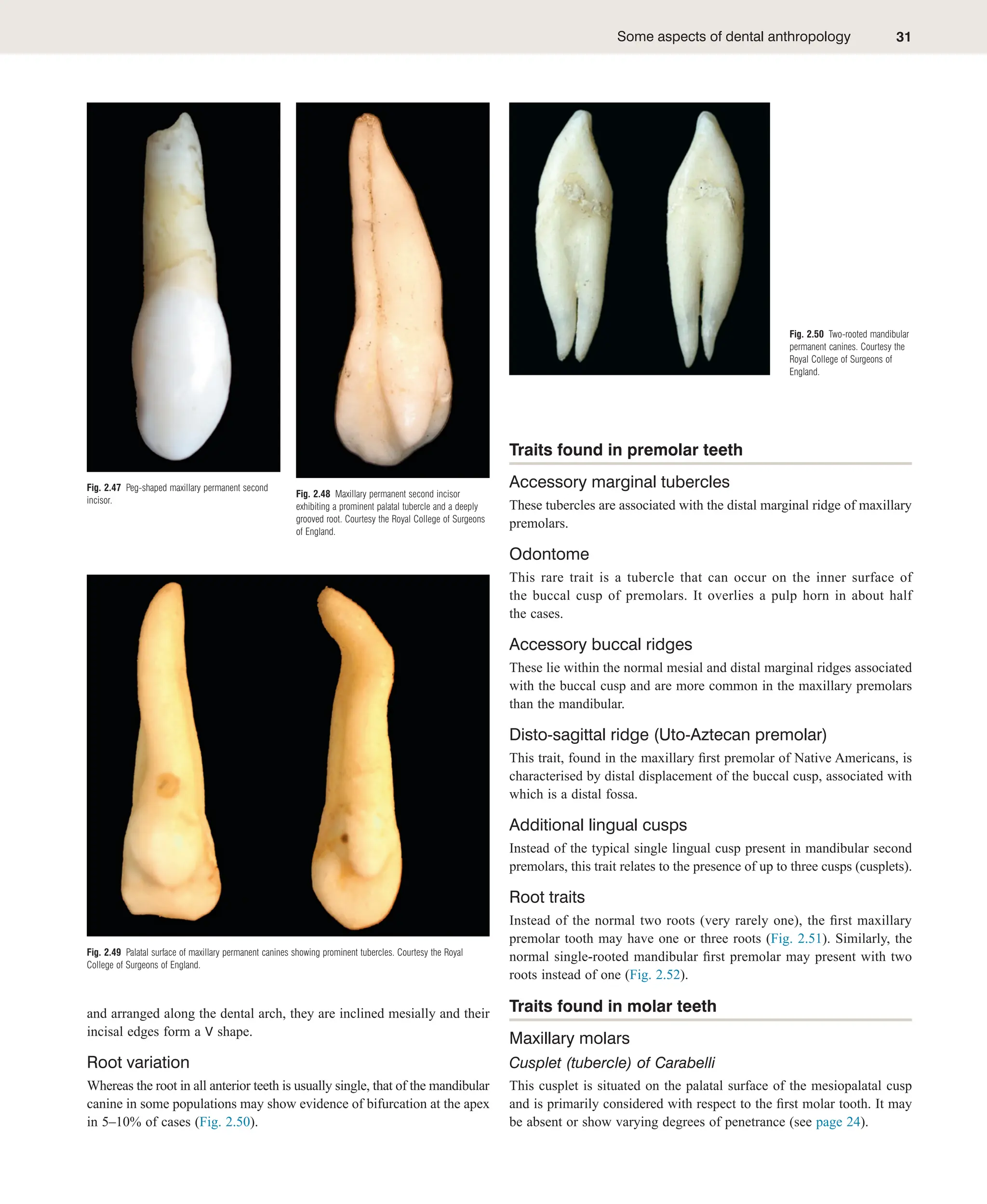 B.K.B. Berkovitz_ G R Holland_ Bernard J Moxham - Oral Anatomy ...