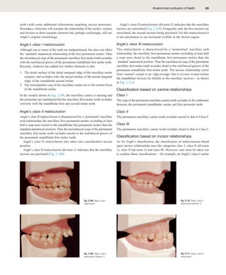 B.K.B. Berkovitz_ G R Holland_ Bernard J Moxham - Oral Anatomy ...