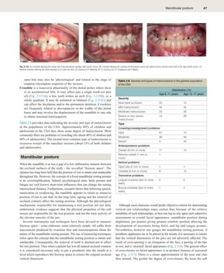 B.K.B. Berkovitz_ G R Holland_ Bernard J Moxham - Oral Anatomy ...