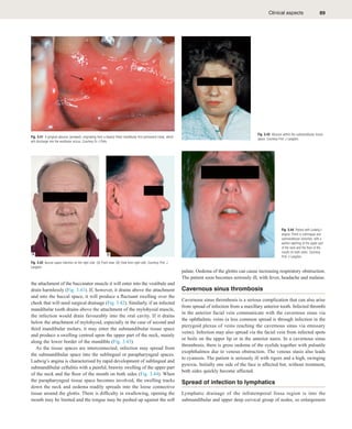 B.K.B. Berkovitz_ G R Holland_ Bernard J Moxham - Oral Anatomy ...