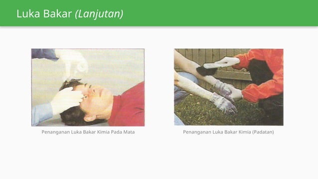 materi pertolongan pertama pada kecelakaan | PPT