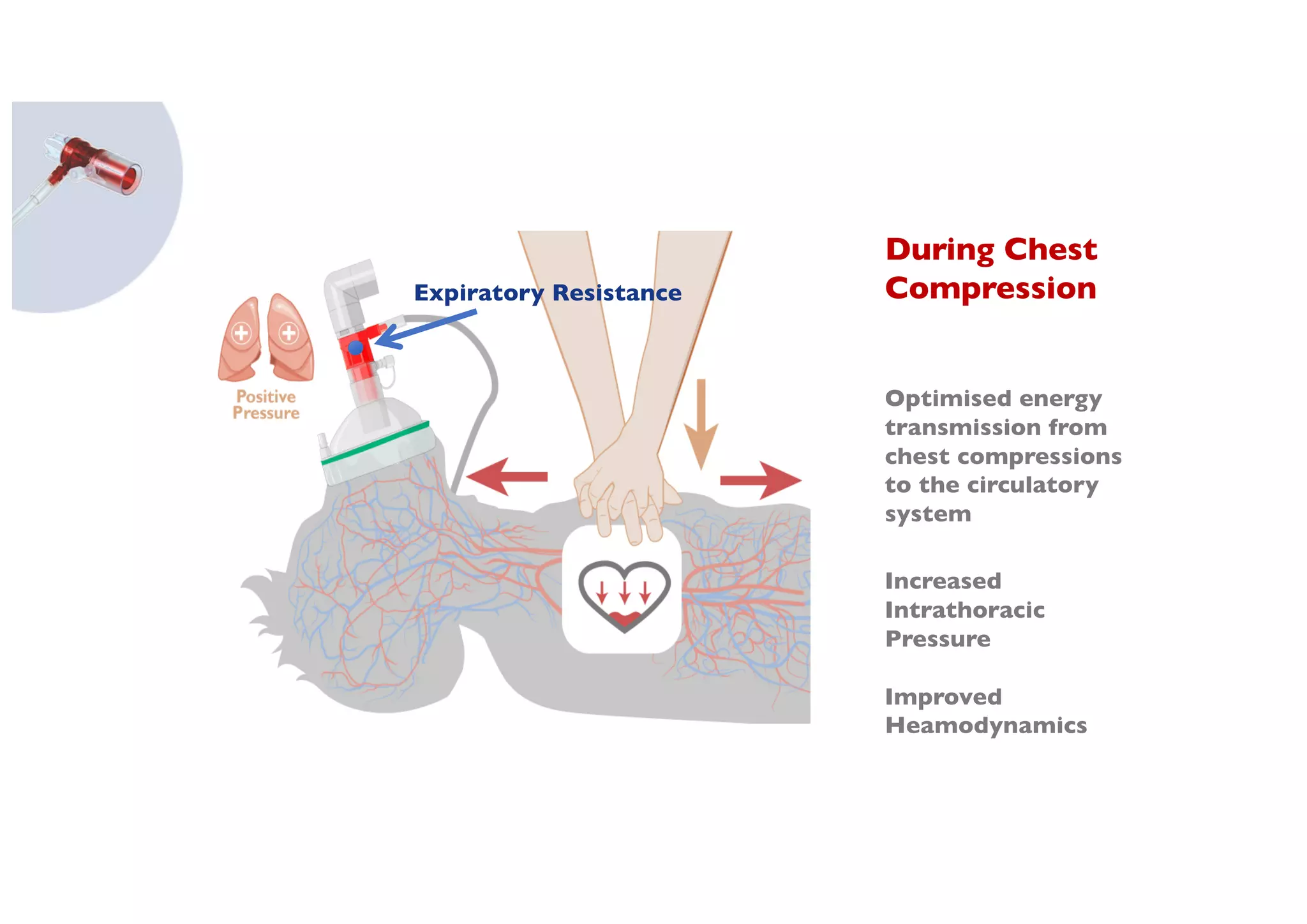 RCP Alveoli Ventilation with Continuous Chest Compression - b-card ...