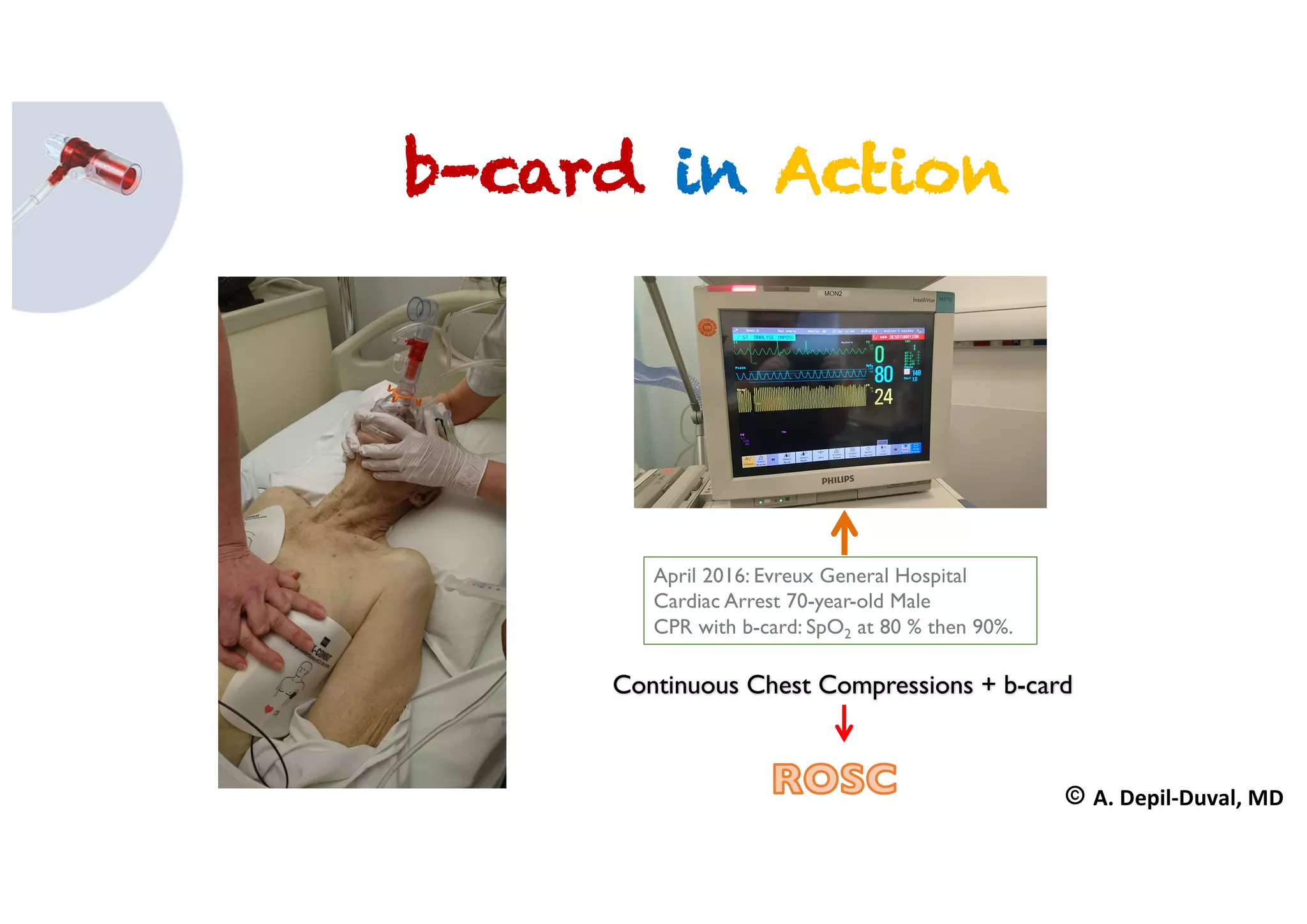 RCP Alveoli Ventilation with Continuous Chest Compression - b-card ...