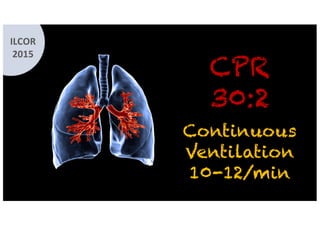 RCP Alveoli Ventilation with Continuous Chest Compression - b-card ...