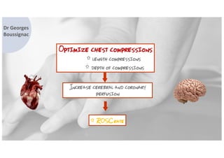 RCP Alveoli Ventilation with Continuous Chest Compression - b-card ...