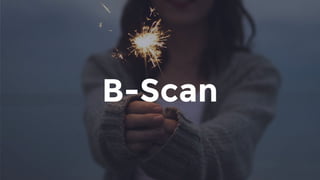 B scan | PPT