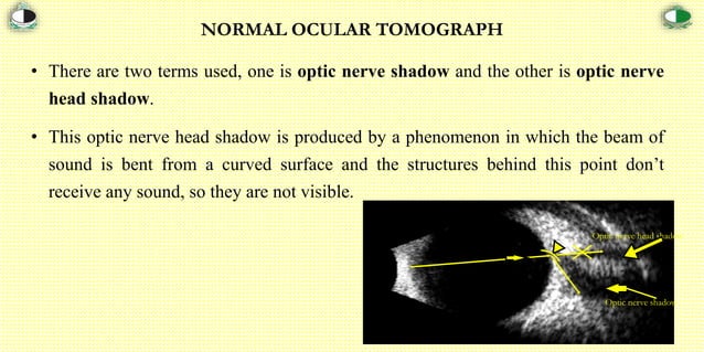 BScan and Ascan in ophthalmology and eye field | PPTX | Eye and Vision ...