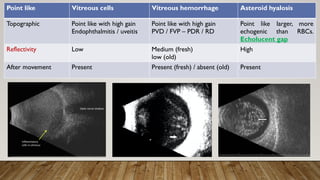 B-Scan procedure basics in ophthalmology.pptx