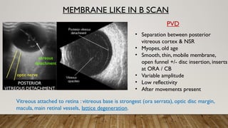 B-Scan procedure basics in ophthalmology.pptx