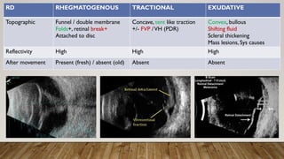 B-Scan procedure basics in ophthalmology.pptx