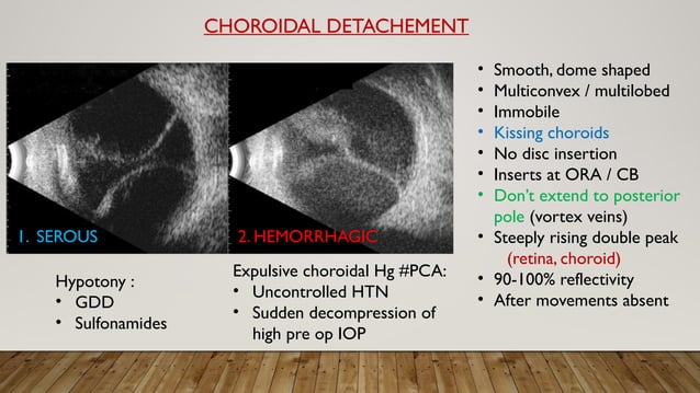 B-Scan procedure basics in ophthalmology.pptx