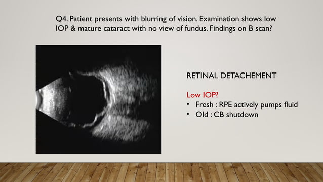 B-Scan procedure basics in ophthalmology.pptx
