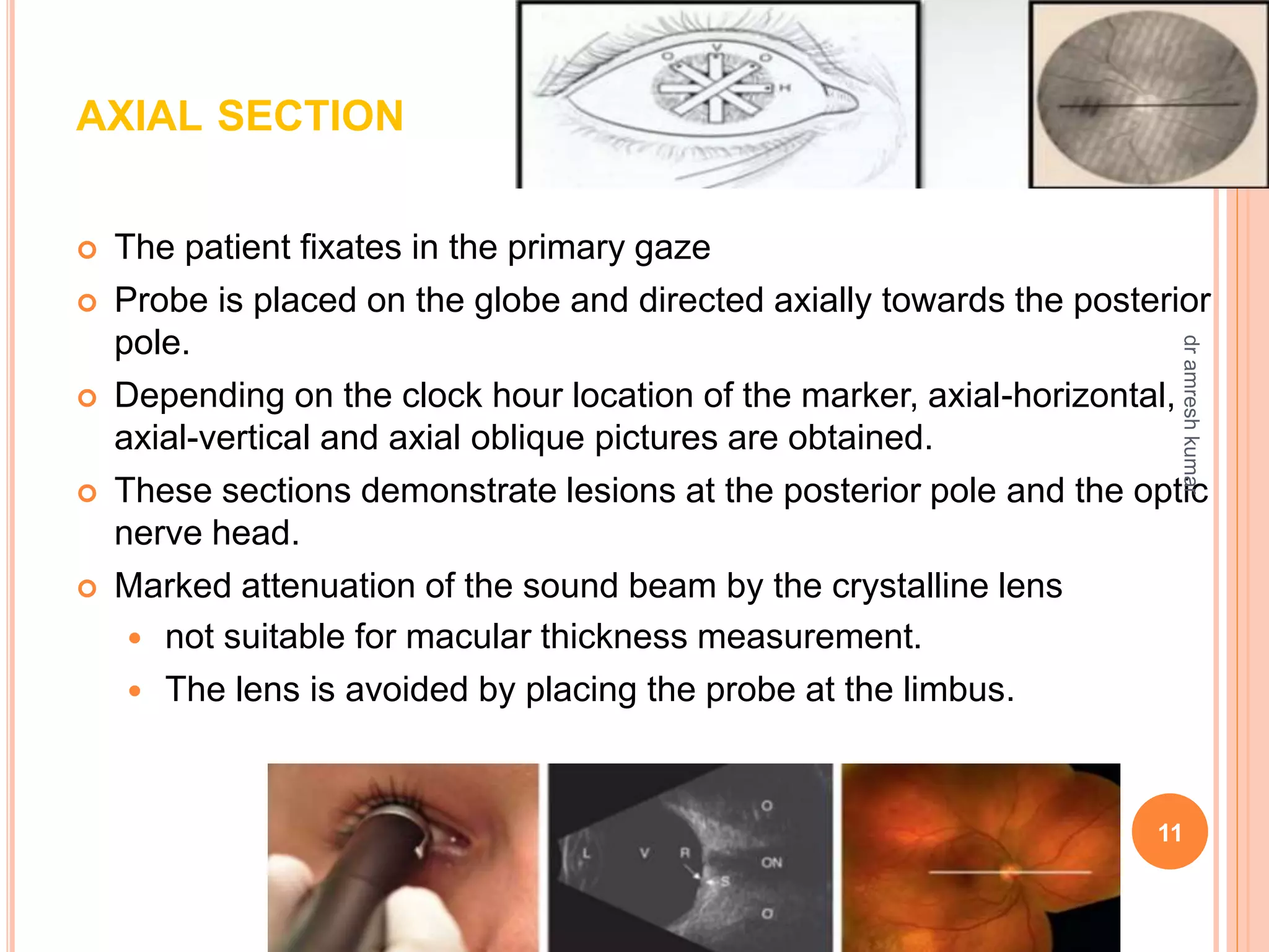 B-SCAN IN OPHTHALMOLOGY.pptx