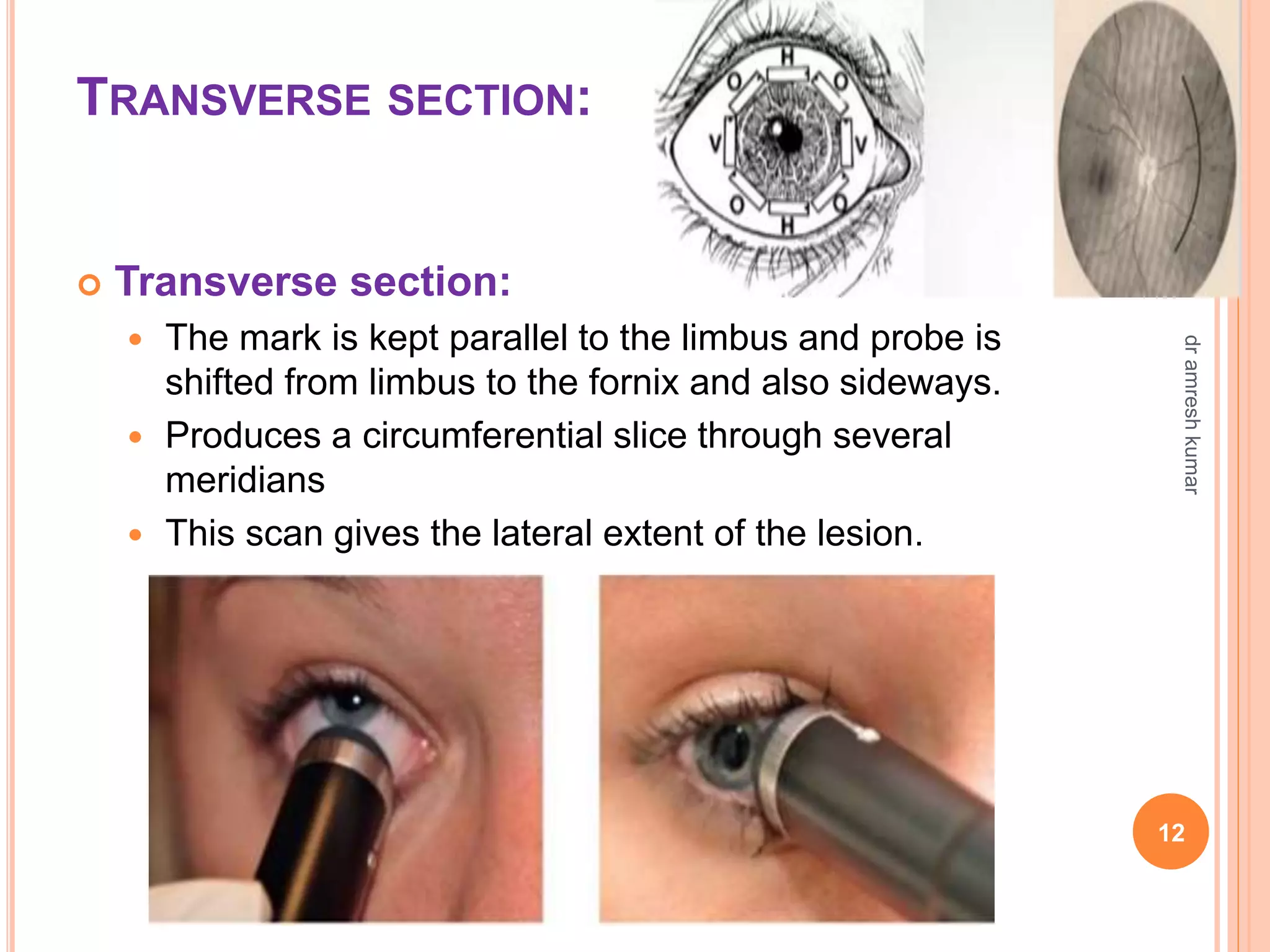 B-SCAN IN OPHTHALMOLOGY.pptx