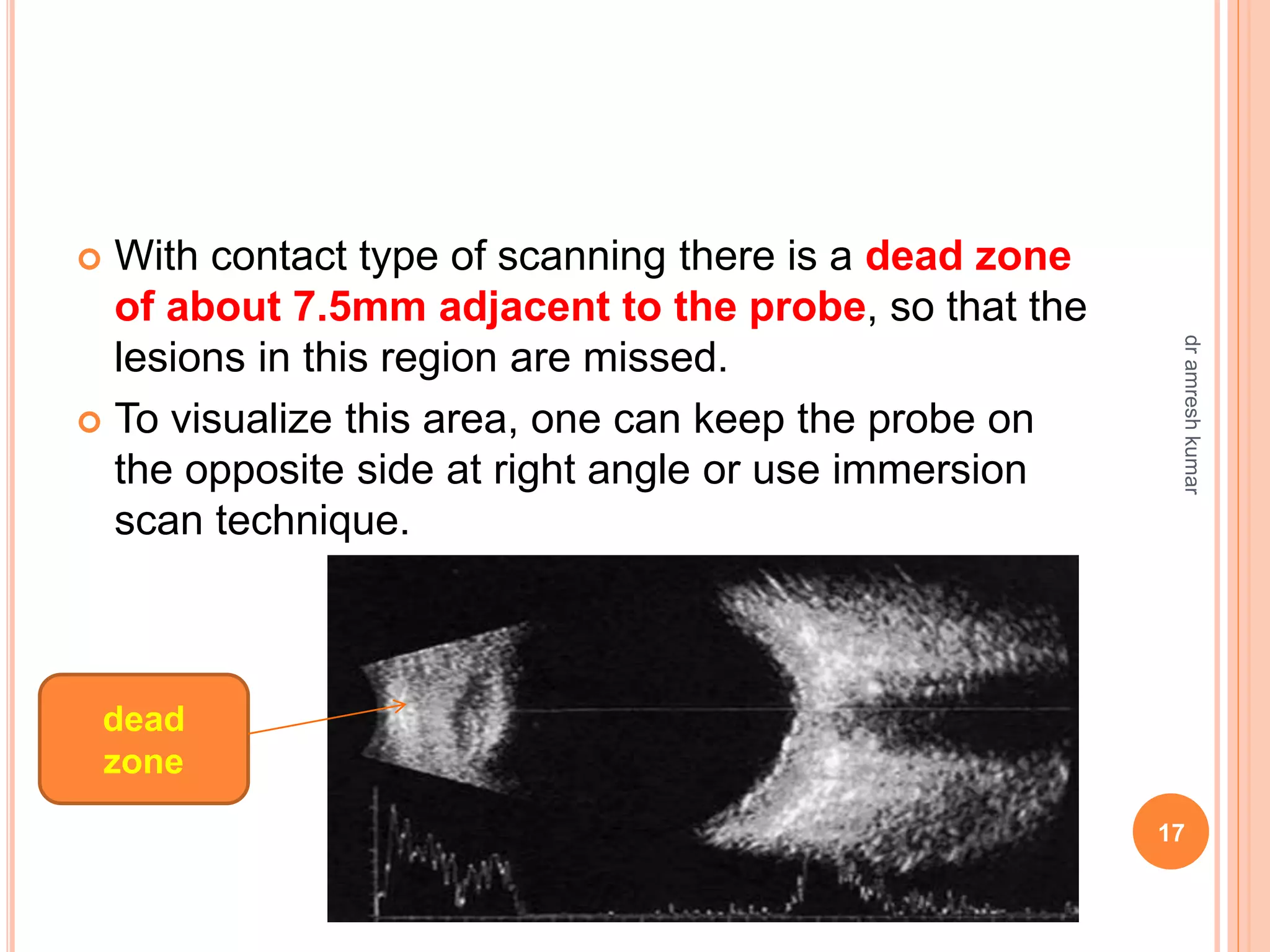 B-SCAN IN OPHTHALMOLOGY.pptx