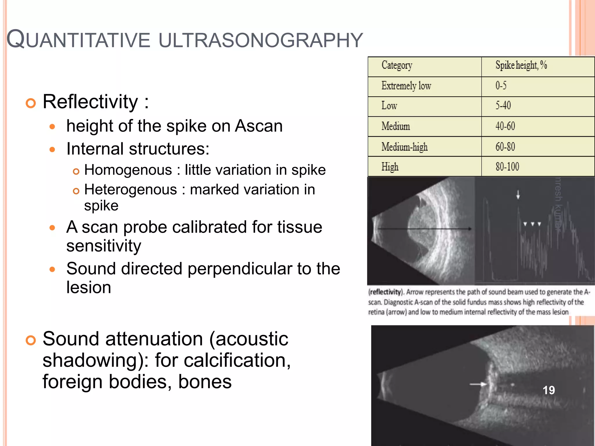 B-SCAN IN OPHTHALMOLOGY.pptx