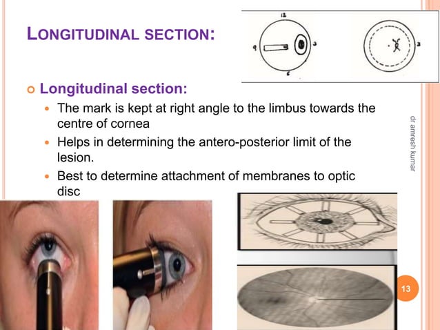 B-SCAN IN OPHTHALMOLOGY.pptx