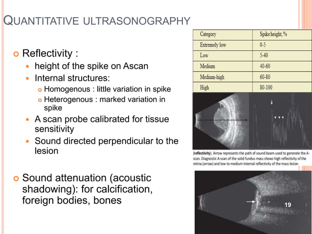 B-SCAN IN OPHTHALMOLOGY.pptx