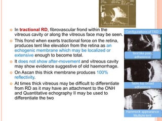 B-SCAN IN OPHTHALMOLOGY.pptx