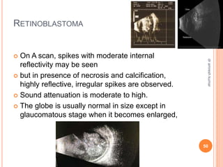 B-SCAN IN OPHTHALMOLOGY.pptx