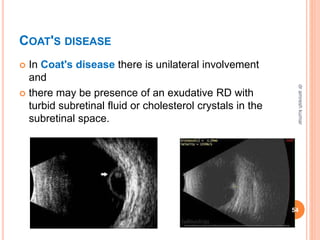 B-SCAN IN OPHTHALMOLOGY.pptx