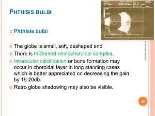 B-SCAN IN OPHTHALMOLOGY.pptx
