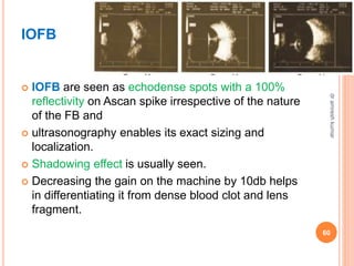 B-SCAN IN OPHTHALMOLOGY.pptx