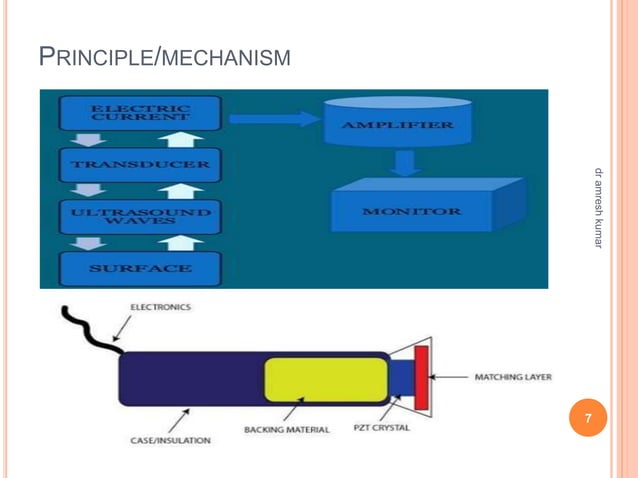 B-SCAN IN OPHTHALMOLOGY.pptx | Eye and Vision Conditions | Diseases and ...